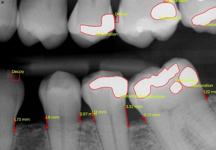 BetterDiagnostics.ai - AI Powered Dental Diagnostics